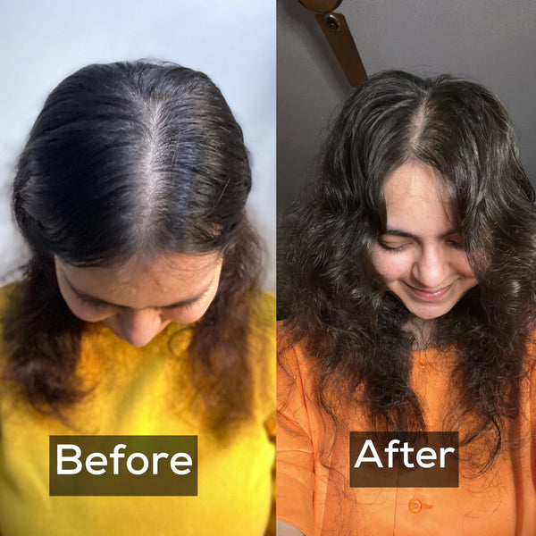 Rosemary Hydrosol For Rapid Hair Growth – Presh Beauti -->